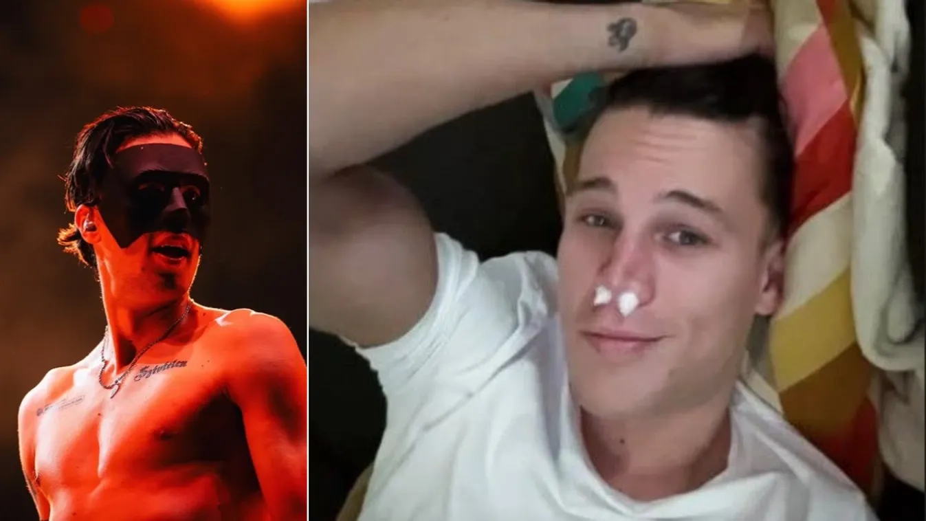 T. Danny már maszkkal takarja eltorzult orrát, ilyen nagy a baj? - Fotó