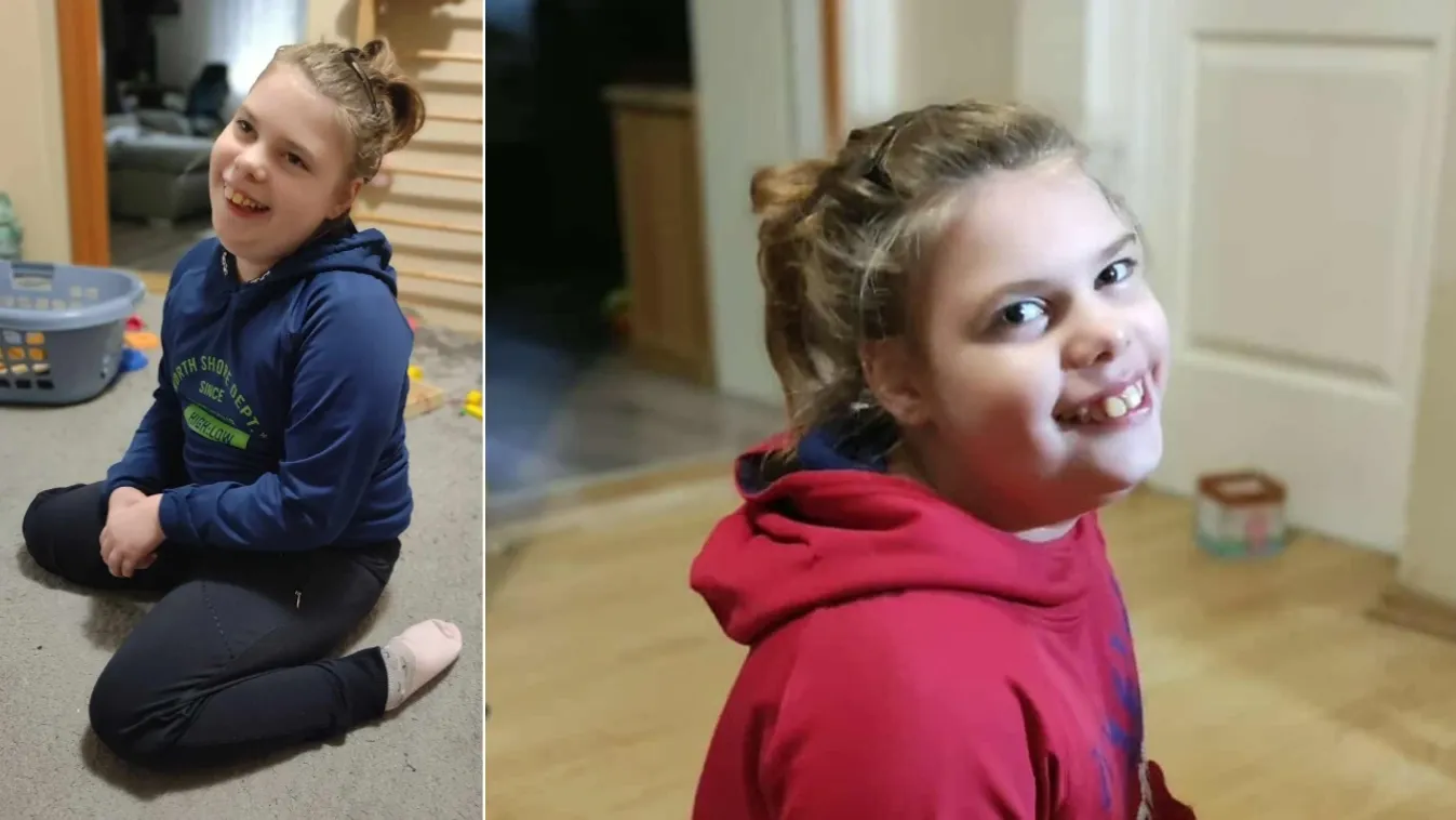 Sztrókkal küzd a 10 éves Hanna, de most lábra állt és jár